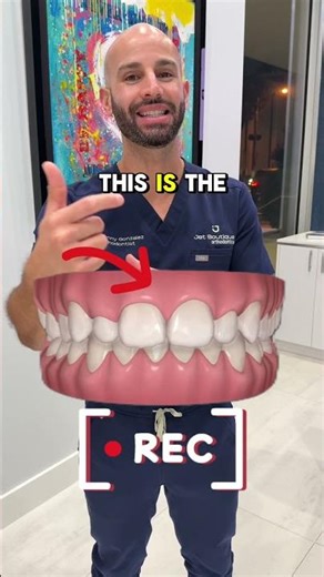 How we use Invisalign to fix this deep bite.