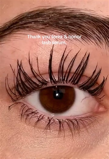 Transform Your Lashes: Before and After with Lash Serum