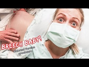 Breech Baby Turning Vlog - Third Trimester Pregnancy