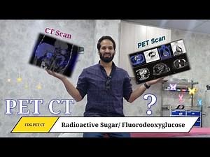 PET-CT Scan Explained | How It Works, History & Uses | By Anis Qureshi