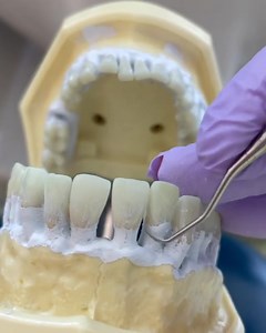 2.6K views · 32 reactions | That Screeching Sound 若 We Dentist live...