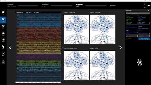 #neurotechnology #bci #highgammamapping #cortiq #medicalinnovation #brainmapping #neuroscience #neurotech #medicaldevices #healthtech #innovation #neurology #clinicalresearch #brainhealth #eeg… | g.tec medical engineering GmbH - NEVER STOP RECORDING