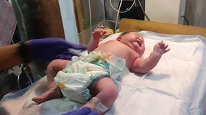 Good Reflexes in IDM Baby – Positive Sign!#baby #hypoglycemia #neonatalcare #cutebaby #cute #healthy #newborn | Anoop Gautam