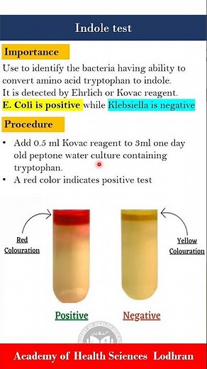 Indole test | Microbiology | by ImranYaseen