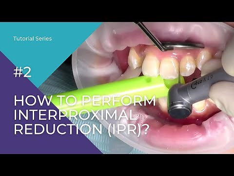 TrioClear® Tutorial Series #2 - How to perform IPR?