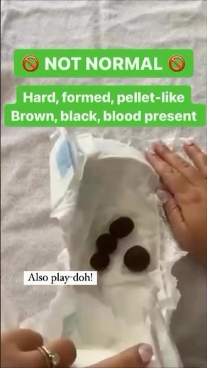 Guide to baby formula poop 💩