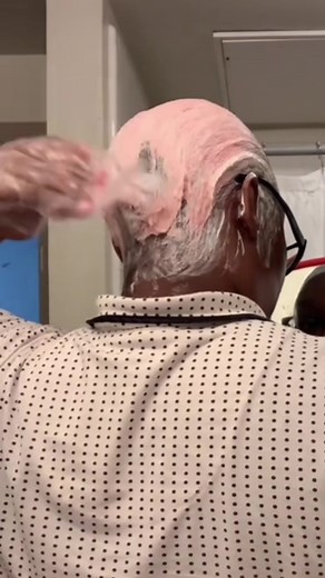 When you over bleach hair😭 #fyp #fypage #bleachhair #hairroutine | people's hair falling out from bleach