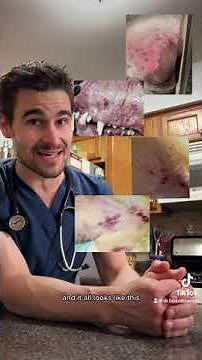 Immune Mediated Thrombocytopenia (ITP or IMT)