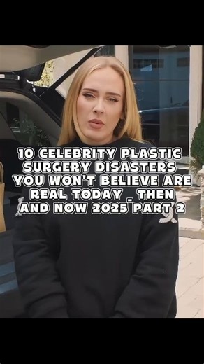10 Celebrity Plastic Surgery Disasters You Won't Believe Are Real Today _ Then and Now 2025 Part 2 #actors #celebrities #longervideos | StarCrest Hollywood | Facebook