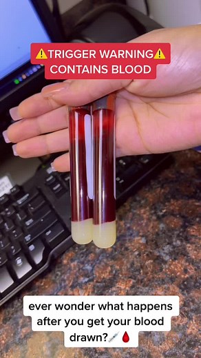 Phlebotomy Training: Exploring the World of Blood Draws