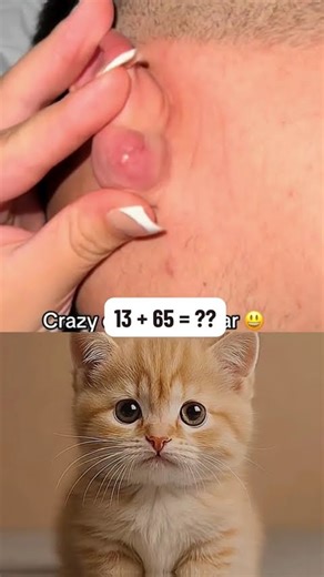 Removing large blackheads and pimples from face new 2026 #12