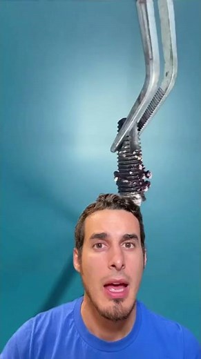 If you wear DENTAL IMPLANTS you should WATCH THIS - Dental Implant INFECTION or PERIIMPLANTITIS