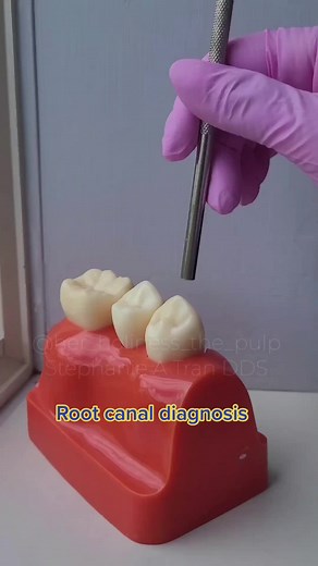 Understanding the Percussion Test in Dentistry