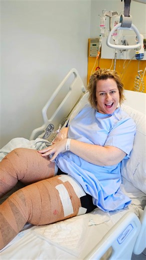 The Bold Body Project on Instagram: "Today I saw my new upper legs for the first time… and I cried. Not out of sadness, but out of relief. For years, I carried the weight of lipedema - literally. My upper legs were so heavy, so swollen, that even simple things like walking or standing still became a struggle. The fat caused by lipedema isn’t like regular fat - it’s painful, resistant to diet and exercise, and it grows disproportionately. My inner thighs rubbed with every step. The chafing was co