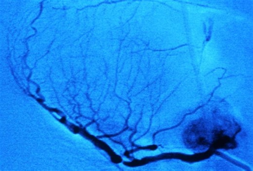 10 Most Costly Inpatient Conditions