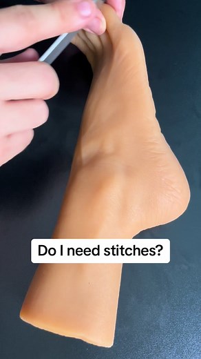 I thought that I’d been hurt before… | stitches