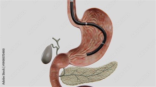 Detailed video of medical illustration depicting a gastroscopy procedure used to visually examine the stomach | Gastroscopy Video in 4K
