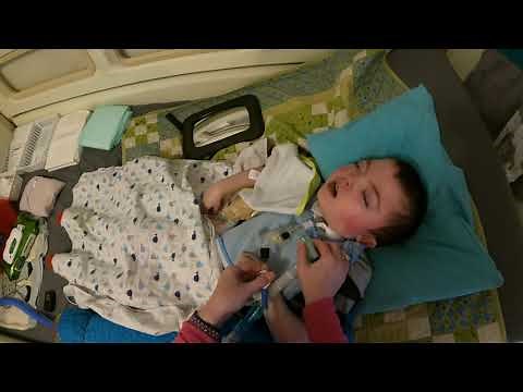 Demonstration Of Inline Suctioning