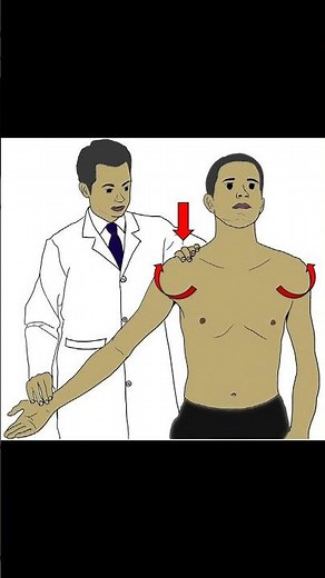 👉 Eden’s Test for Thoracic Outlet Syndrome Explained #meded #physiotherapy #atc #orthopedic #medical
