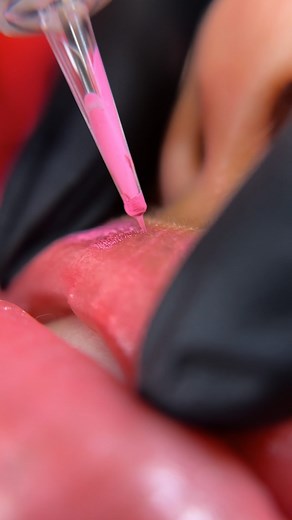 𝐕𝐚𝐥𝐞𝐫𝐢𝐢𝐚 𝐇𝐨𝐫𝐢𝐮𝐤 PMU TRAINER San Diego on Instagram: "📸 Dark Lips Neutralization: Before-After! ✨👄 Witness the incredible power of neutralizing dark lips in this jaw-dropping transformation! ✅Here we had the 3rd LEVEL of pigmentation! This particular case presented a significant challenge with a clearly defined border between pigmented and non-pigmented lip skin🫦 🎥 Make sure to watch the video, where I reveal the secret products I used to achieve this stunning transformation! 💄