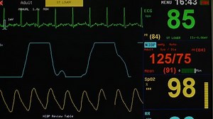 Ekg Monitor Icu Unit Show Waves Stock Footage Video (100% Royalty-free) 17088238 | Shutterstock