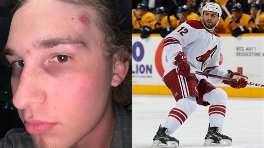 Phoenix assault victim says suspect was the same person who attacked Paul Bissonnette
