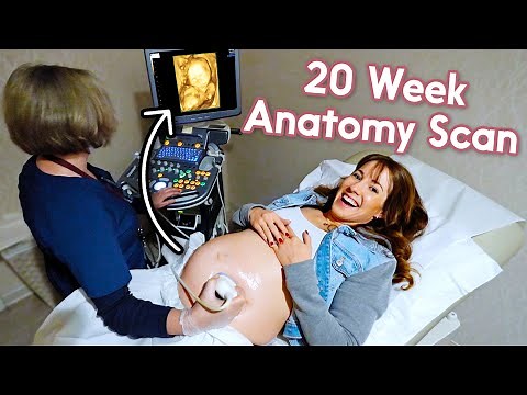 MY 20 WEEK PREGNANCY ANATOMY SCAN!!! - She Confirms the Gender of Our Baby!