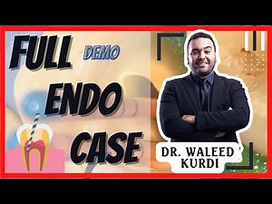 Demo | How to do a root canal treatment from ACCSES cavity to OBTURATION | Dr. Waleed Kurdi