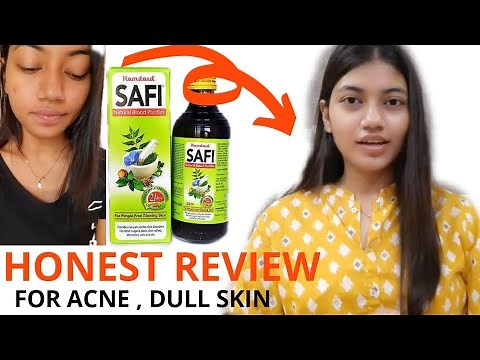 SAFI/ Honest Review/ Get rid of pimples/ Benefits and side effects// Pragya Arya