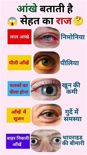 आँखे बताती है सेहत का राज|आँखो से कैसे पहचाने शरीर की बिमारीयों को|Eyes reveal the secrets of health