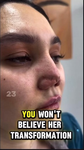 She Lived in Pain and Pity — Until a Doctor Gave Her a Face She Deserved Check full video in comments⬇️ | Interesting Stories