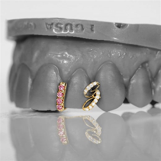 Custom Script Diamond Initial “G” and a Pink Diamond Gap Filler 💕💎