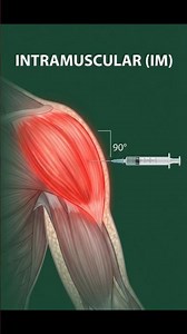 SITES OF INJECTION – LABELED DIAGRAM#medicosaheli #medicaleducation