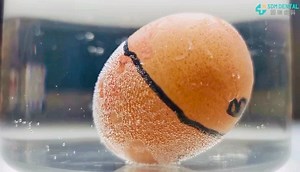 每天刷牙的你，知道为什么要使用含氟牙膏呢