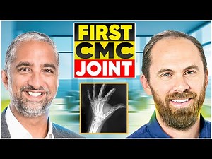 First CMC Joint Osteoarthritis: Effective Management and Treatment Options