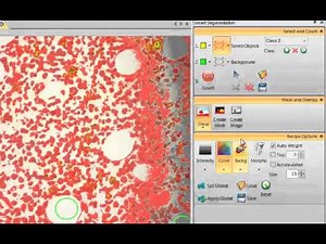 Smart Segmentation Video Tutorial - Image-Pro Premier Software