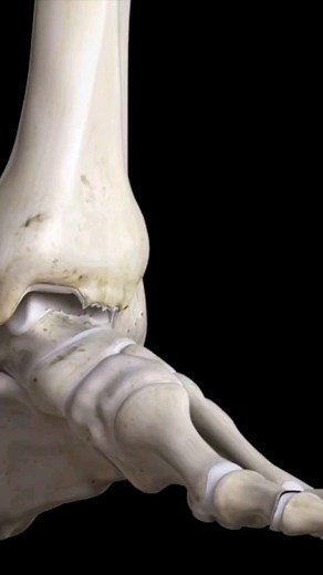 First Choice Health Care on Instagram: "Did you know? Ankle spur removal is a fascinating medical procedure aimed at relieving discomfort caused by bony growths on the ankle joint. Here are some interesting facts about it!! @first_choice_health_care @first_choice_health_care @first_choice_health_care @first_choice_health_care @first_choice_health_care .................... ....................... #physiotherapystudent #physiotutors #cranialnerves #physiotherapistlife #physiotherapy_world #physiot