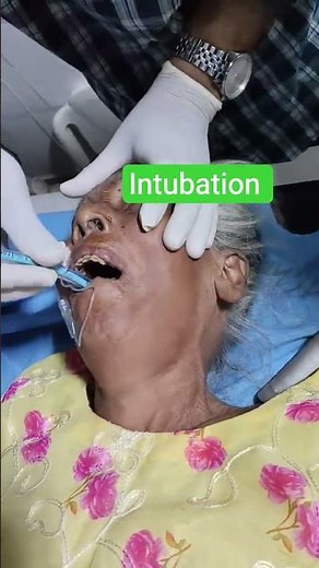 Endotracheal intubation #intubation