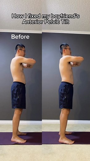 If you are like my boyfriend who has been sedentary for years, works for a corporate job, and feels lower back pain occasionally, this routine will help you to feel better! How to fix anterior pelvic tilt: 1. Cat cow mobilization first 2. Stretch the tight muscles: hip flexor and glute 3. Strengthening weak muscles: glute bridge 4. Strengthening the core for better spinal support Make sure to do these exercises daily to get the best result and be aware of your daily posture so you don’t go back