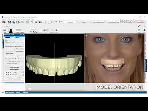 NemoSmile Demo - Digital Smile Design software_English