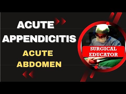 ACUTE APPENDICITIS- How To DIAGNOSE & TREAT / RLQ PAIN