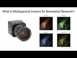 Monitoring Blood Flow and Oxygen Saturation using a Multispectral Camera