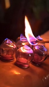 🔥 Fire cupping uses heat to create a negative pressure (vacuum) inside glass or bamboo cups. A flame is quickly introduced into the cup to heat the air, then removed immediately before placing the cup on the skin. As the air inside the cup cools rapidly, it contracts—this creates a suction effect that draws the skin and superficial muscle layer into the cup. Note: We do not perform fire cupping at our office—this post is for educational purposes only. #FireCupping #MyofascialRelease #Chiropract