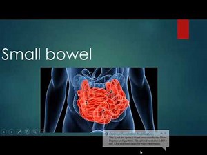 12- small bowel disorders