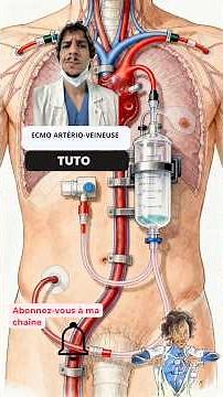 Understanding and preventing arteriovenous ECMO #nurse #tutorial #blood #tips #catheter #best #nurse
