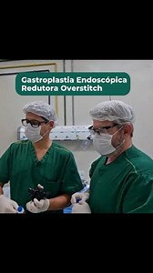 Conheça mais detalhes sobre a Gastroplastia Redutora Endoscópica com Overstitch Trata-se da Técnica de Redução do Estômago por Endoscopia sem cortes. Seu objetivo é ser uma opção minimamente invasiva para auxílio no tratamento da Obesidade. @matzfelipe @flavioramos Deixe aqui suas dúvidas! Conheça os métodos minimamente invasivos, que aceleram o emagrecimento saudável e reeducação alimentar, auxiliando também na remissão das doenças associadas: ■ Balão Intragástrico ■ Gastroplastia Endoscópica R