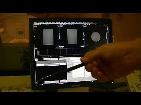 How to run a BASIC head scan on a Siemens Syngo MRI.