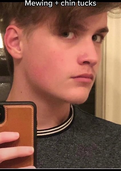 Enhance Your Jawline with Mewing and Chin Tucks