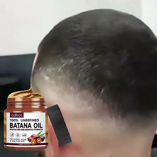 EELHOE Batana Oil Conditioner - Prevents Hair Loss, Repairs, Thickens, Lengthens, Moisturizes