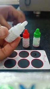 RA factor test procedure (rheumatoid factor test) #dmlt_classes #paramedical #RA factor test